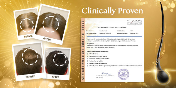 Buy Sesa Ayurvedic Regain 2 Step Hair Growth Kit - Reduces Hairfall ...