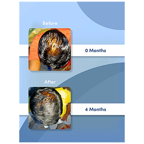 Buy Man Matters Anti Hairfall Shampoo Online at Best Price of Rs 399 ...