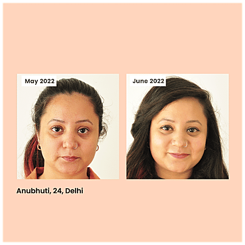 Buy foxtale Ceramide Supercream Hydrating Moisturizer - Evens Out Skin ...