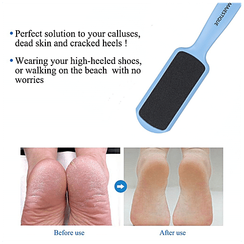 Buy MAJESTIQUE Dual Side Foot Care File - Callus Remover File Rasp ...