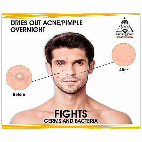 Buy urban gabru Acne/Pimple Patch - 100% Hydrocolloid, Absorbs Pimple ...